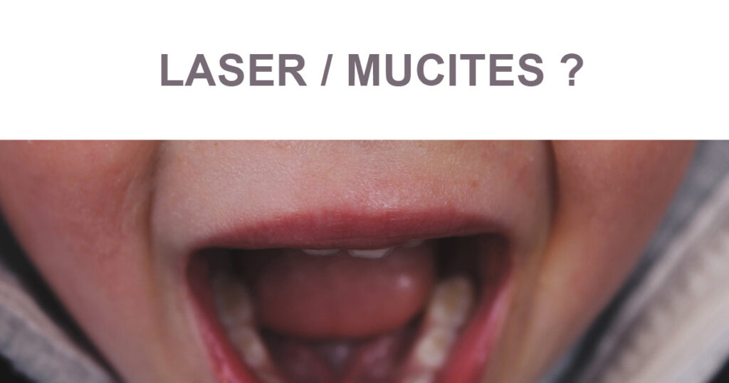 Directives pour les MUCITES, effets secondaires d'une thérapie anti ...